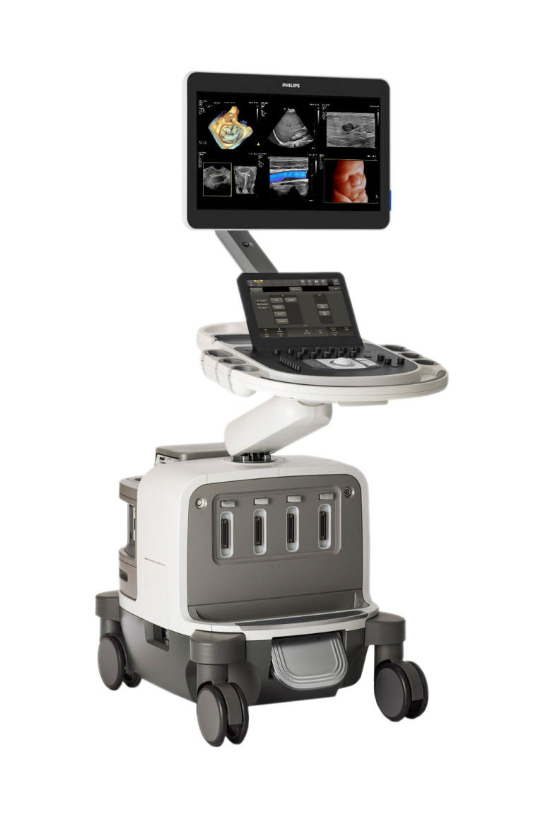 Ultrasound | Beyond Radiology