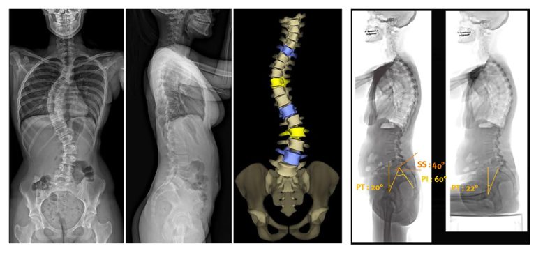 Introducing EOS imaging technology to New Zealand